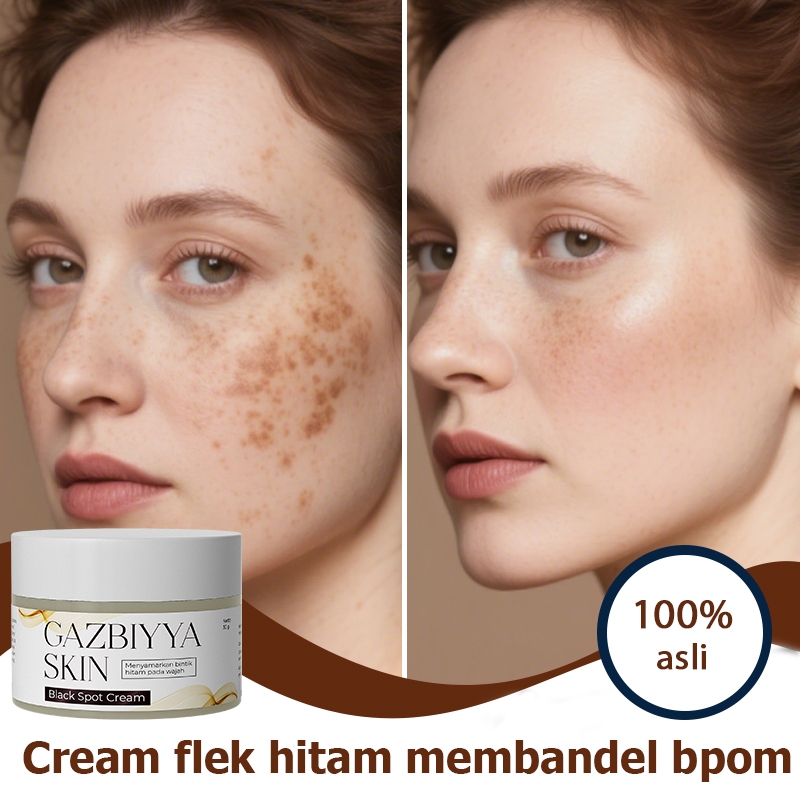 Jual 【BPOM】Cream flek hitam membandel bpom krim penghilang flek hitam serum flek hitam membandel ...