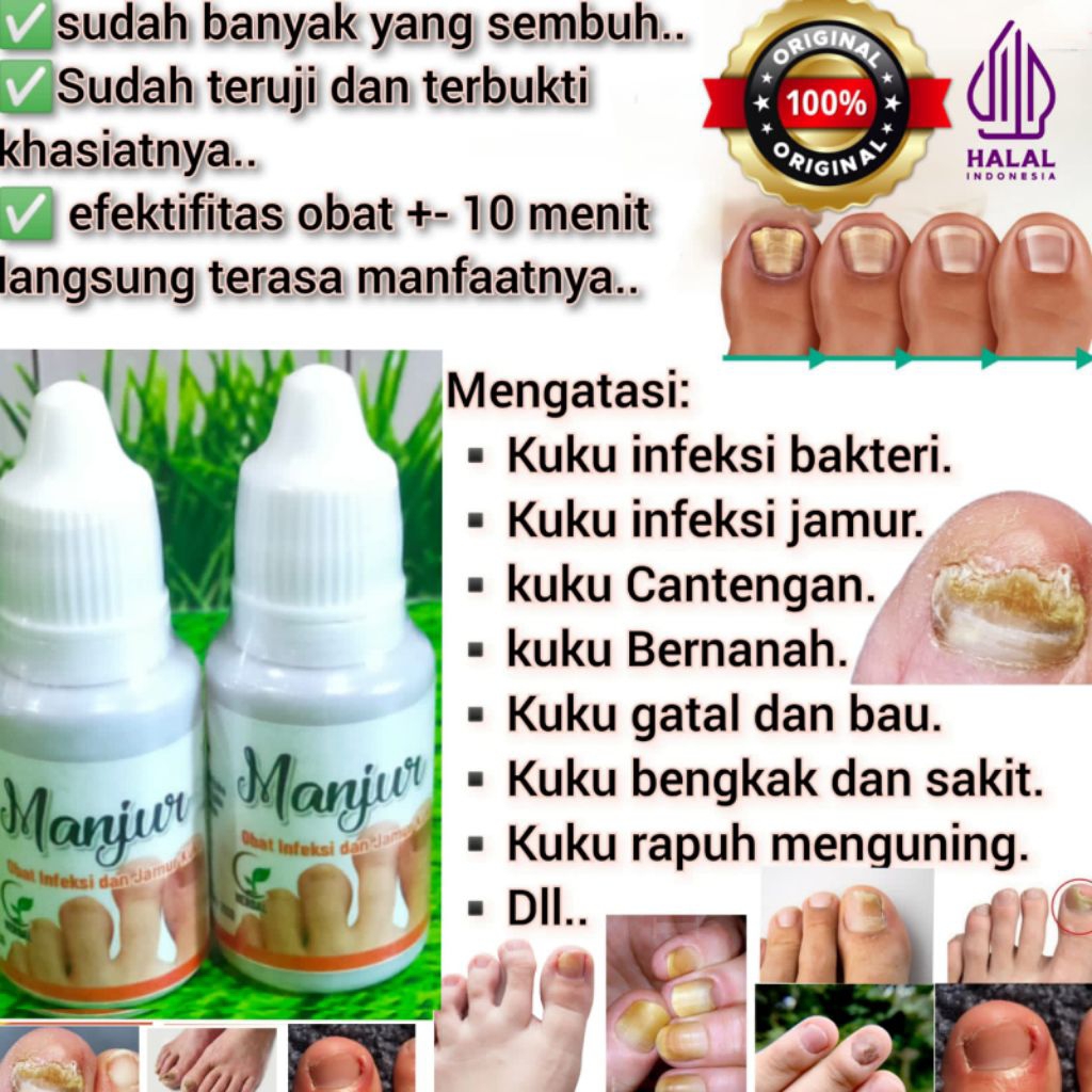 Jual obat kuku bernanah sakit bengkak infeksi jamur bakteri bau busuk ...