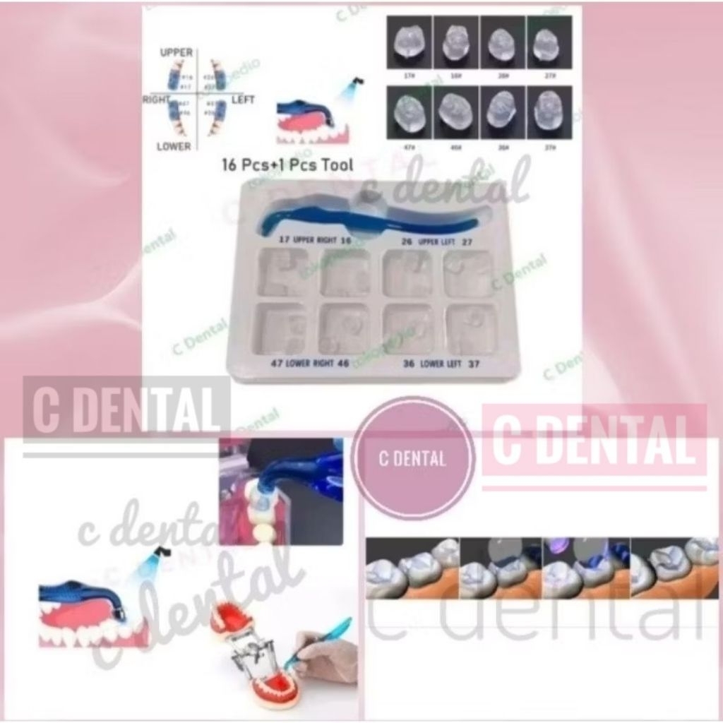 Jual [1 Set] Dental Molar Occlusal Pit Fissure Stamp Shaping Composite ...