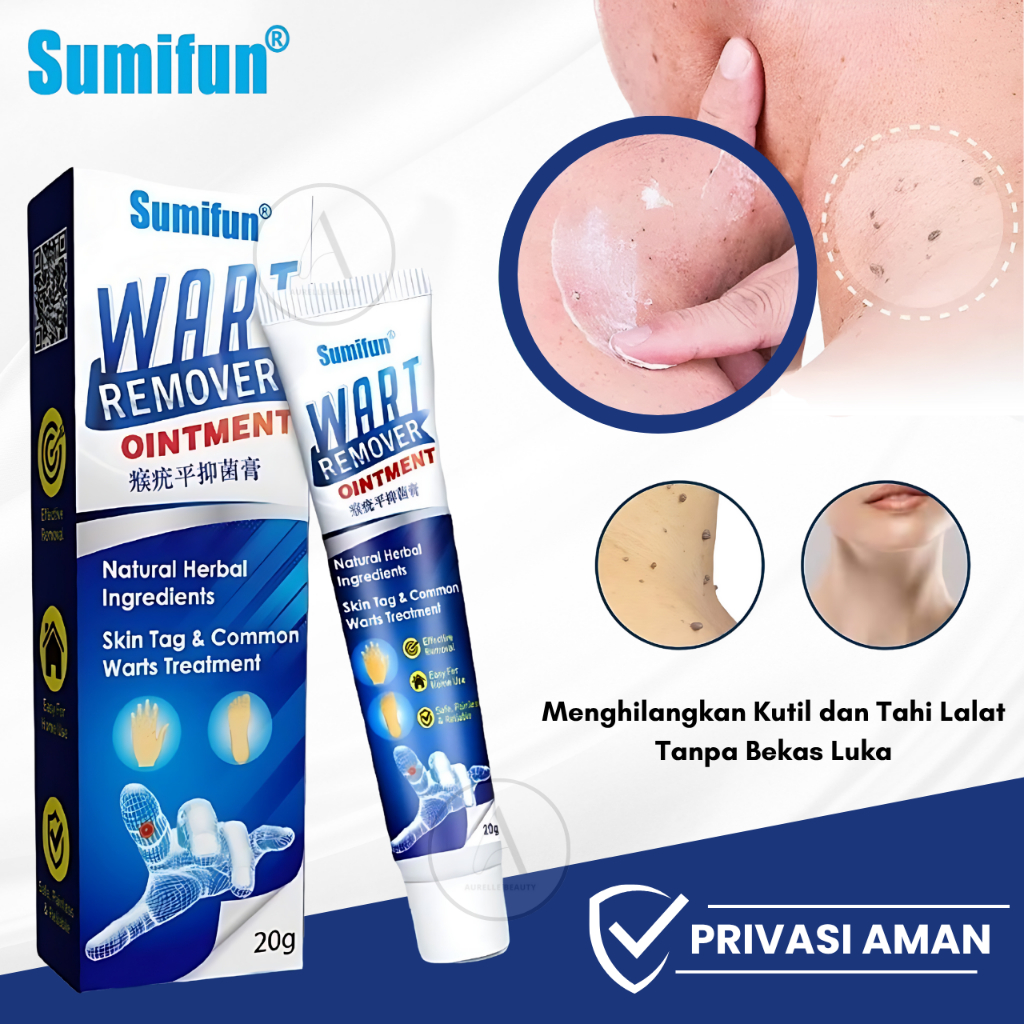 Jual SUMIFUN Wart Remover Ointment Krim Penghilang Tahi Lalat Mata Ikan Kutil Ampuh Tanpa Perlu ...