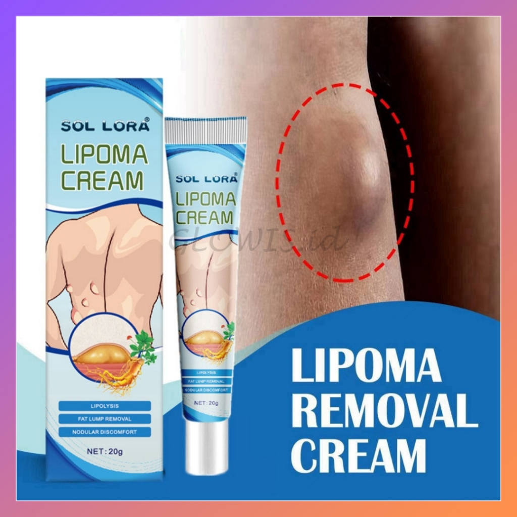 Jual SOL LORA Lipoma Cream Salep Herbal untuk Mengatasi dan Mengobati Benjolan Lemak & Lipoma ...