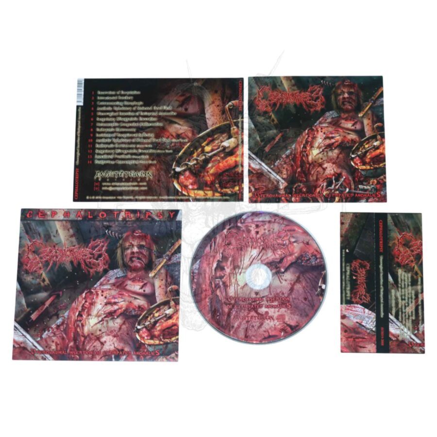 Jual CD – CEPHALOTRIPSY – Uterovaginal Insertion Of Extirpated ...