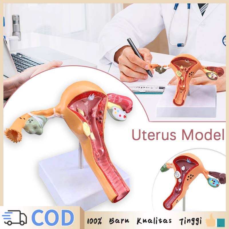 Jual Manikin Uterus Ovary Model Patologis Uterus Alat Peraga Anatomi ...