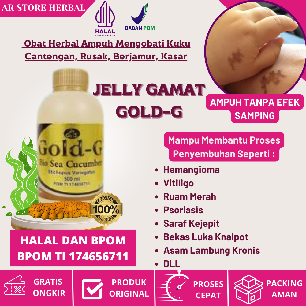 Jual Jelly Gamat GOLD-G Solusi Herbal Hilangkan Tanda Lahir Pada Anak ...