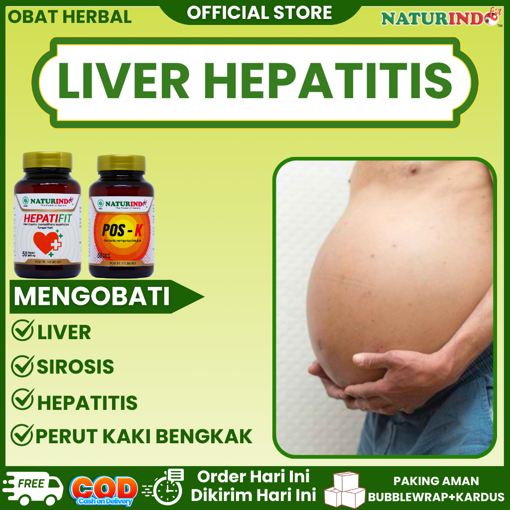 Jual Obat Liver Herbal Hepatitis Sirosis Perut Membesar Kaki Bengkak Mata Kuning Hepatifit ...