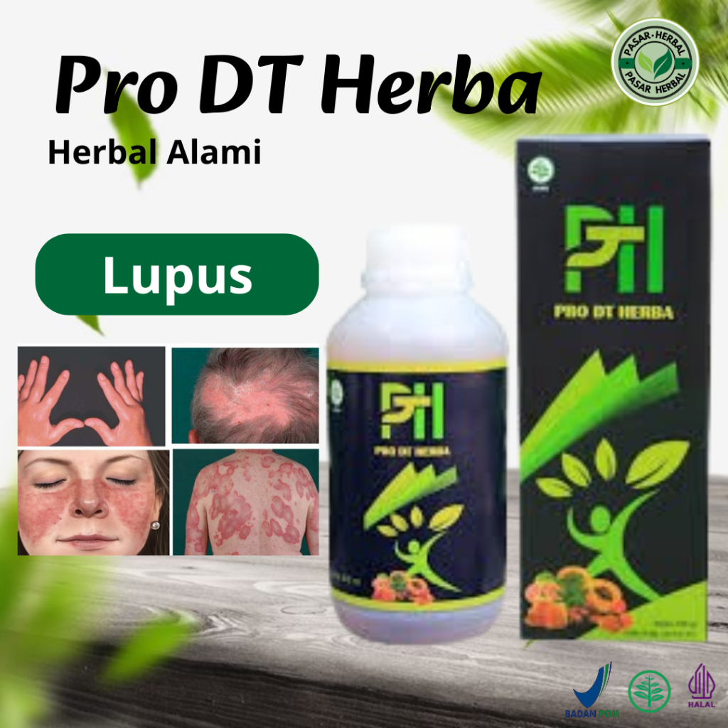 Jual Obat Lupus Ruam Wajah Autoimun Antibiotik Kulit Bersisik Kering ...