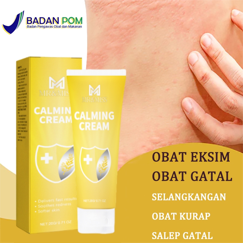 Jual 【beli 2 gratis 1】Salep gatal Salep Eksim Salep kulit Krim ...