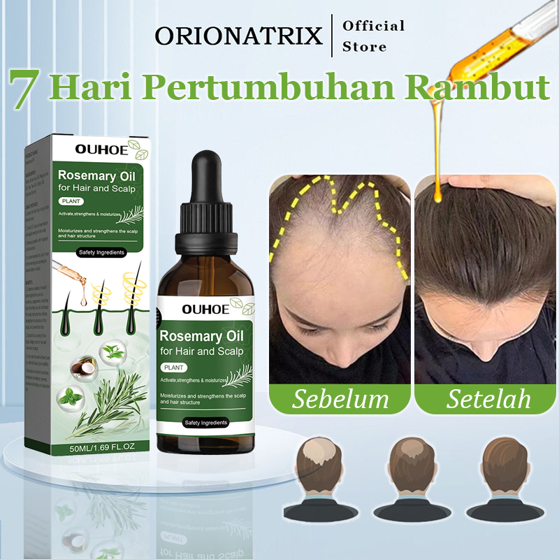 Jual Orionatrix Hair Serum Penumbuh Rambut Botak Minyak Rosemary Oil ...