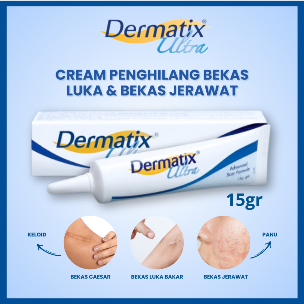 Jual Dermatix Ultra 15gr Cream Penghilang Bekas Luka, Bekas Jerawat ...