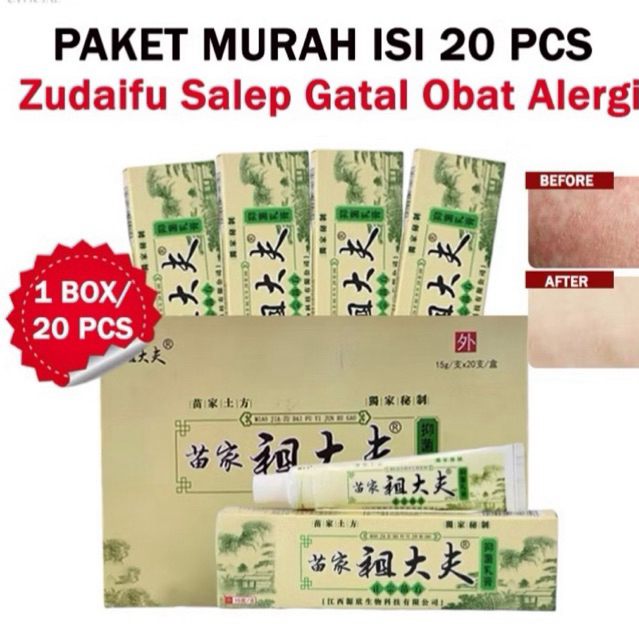 Jual (DAPAT 20 PCS ) ZUDAIFU SALEP KULIT GATAL UNTUK ALERGI GATAL RUAM ...