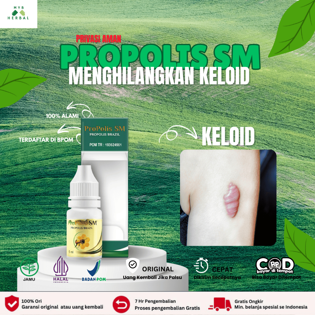 Jual TERBUKTI Propolis SM Obat Keloid Penghilang Bekas Luka Daging ...