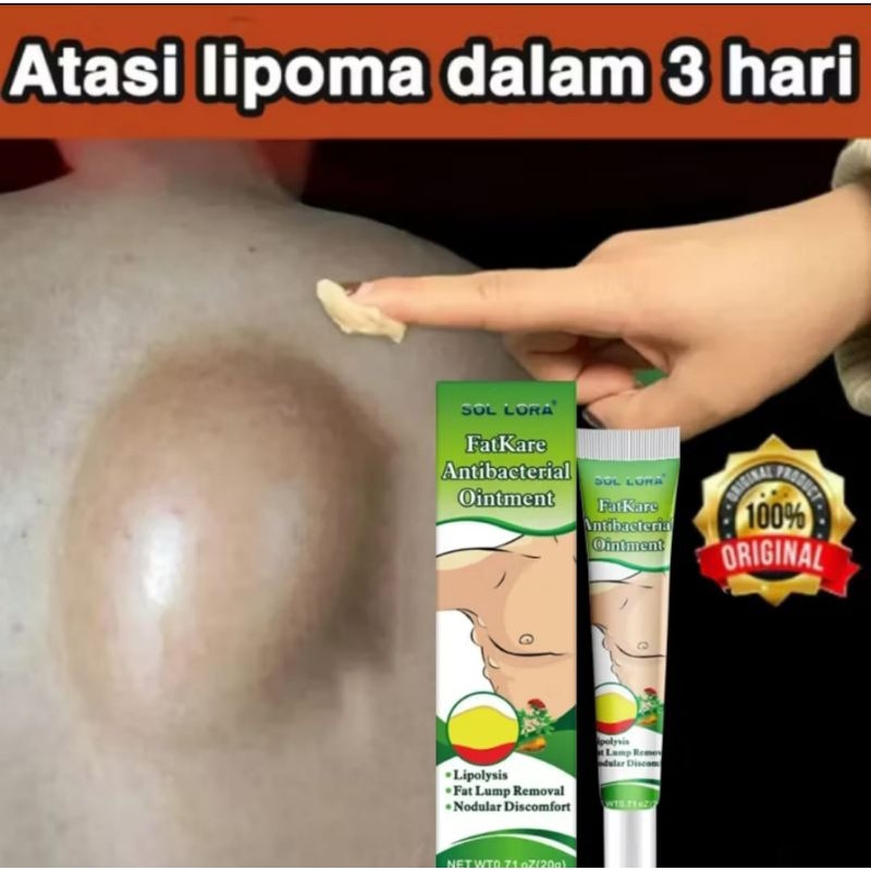 Jual LIPOMA REMOVAL CREAM CELLULITE SUMIFUN & SOL LORA tube 20 gr | Shopee Indonesia