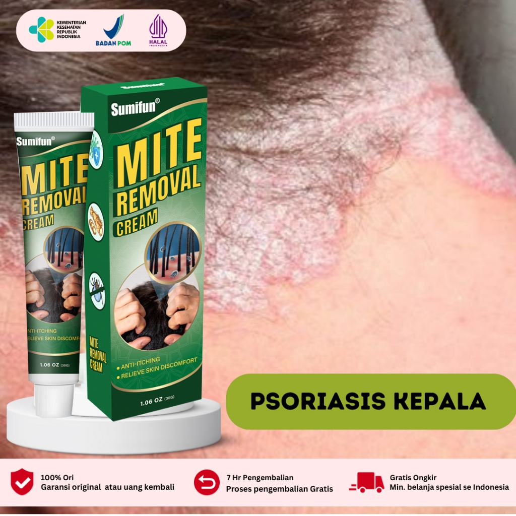 Jual Sumifun Cream ketombe Obat Ketombe rambut Anti itching cream 20g Obat Dermatitis Seboroik ...