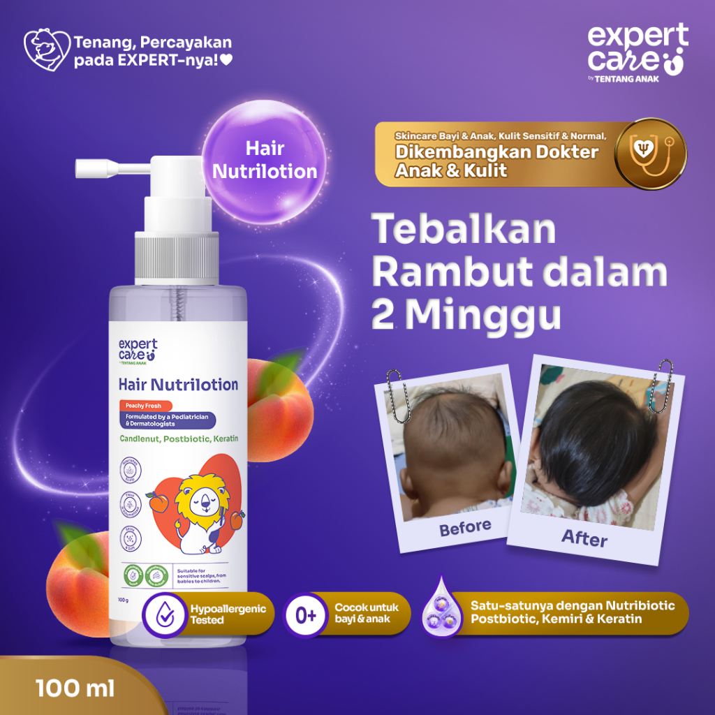 Jual Hair Lotion Anak & Bayi - Expert Care Hair Nutrilotion 100ml ...