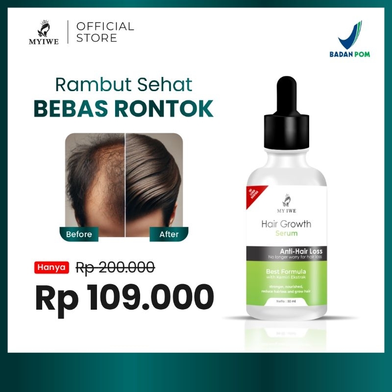 Jual My Iwe Hair Growth Serum Vitamin Rambut Penumbuh Rambut Atasi ...