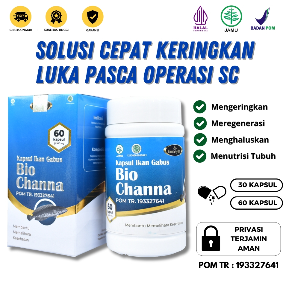 Jual Kapsul Kutuk Ikan Gabus Premium Channa striata Biochanna 30 & 60 ...