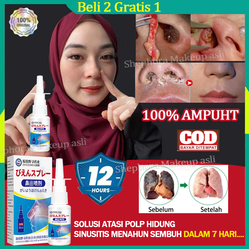 Jual nasal spray obat polip hidung obat sinusitis hidung tersumbat obat sinusitis paling ampuh ...