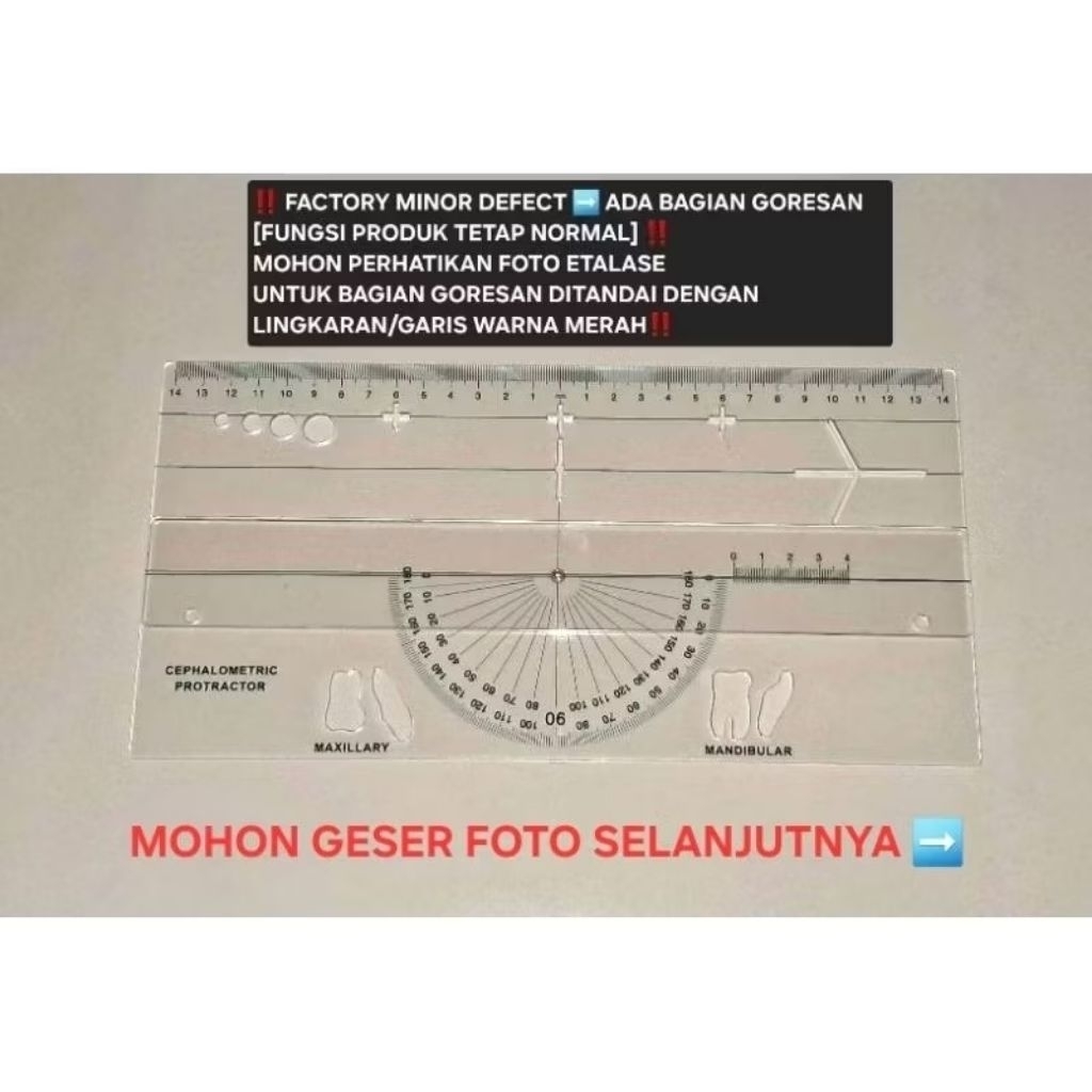 Jual Dental Orthodontic Cephalometric Tracing Ruler Sefalometrik ...