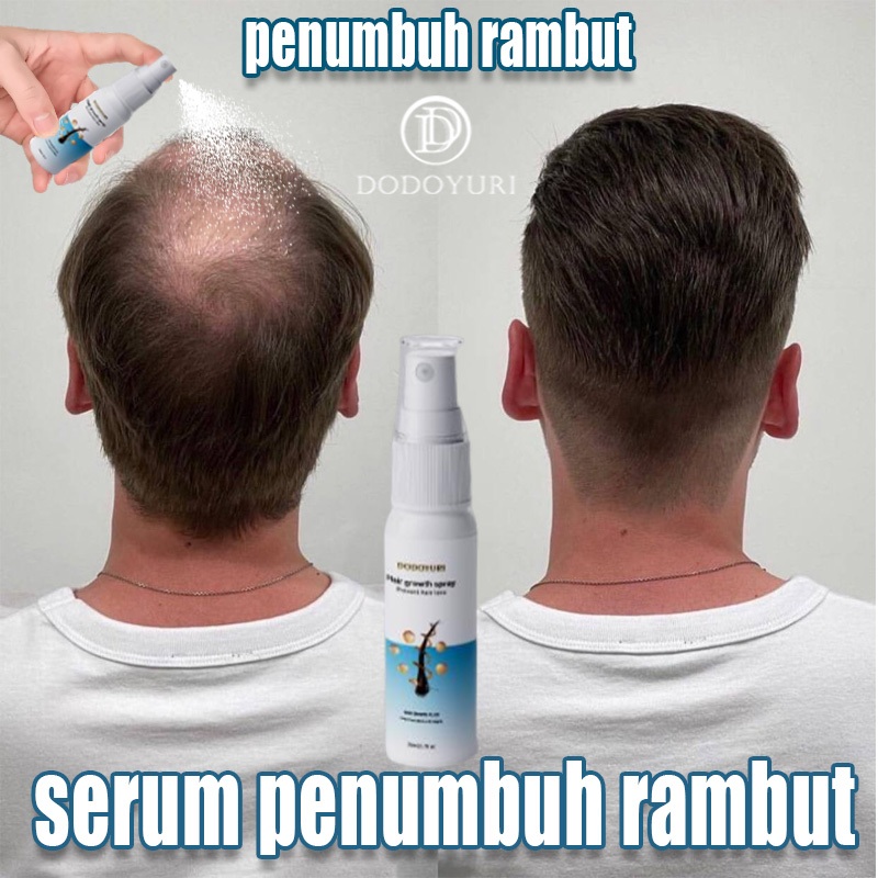 Jual BPOM DODOYURI Penumbuh rambut botak Serum penumbuh rambut Obat ...