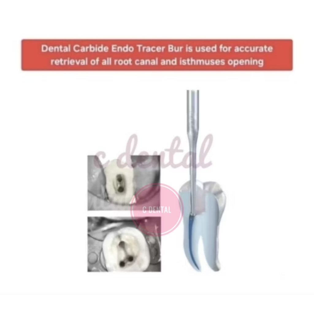 Jual Dental Endo Orifice Tracer Bur Carbide Long Shank Opening Access ...