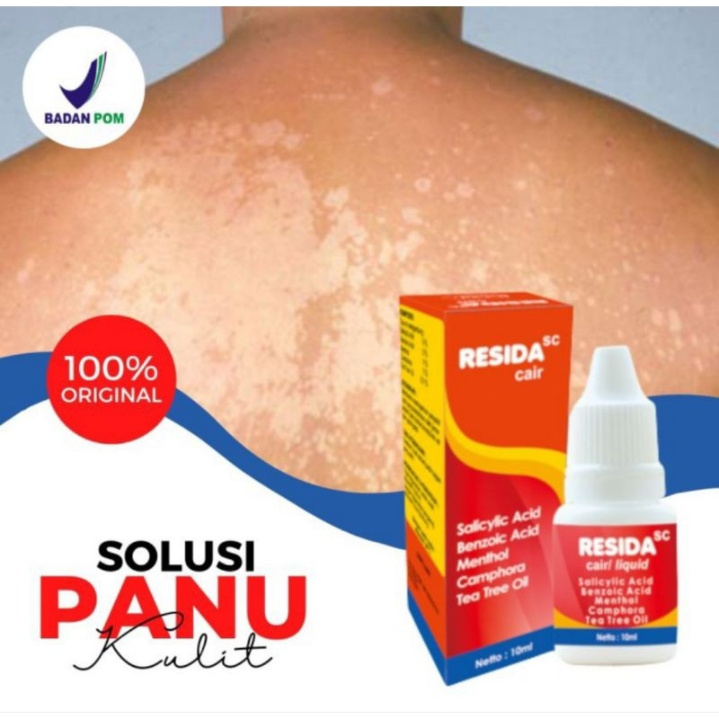 Jual OBAT PANU KADAS KURAP JAMUR KULIT EKSIM GATAL SELANGKANGAN RESIDA CAIR 10ML AMPUH AMAN ...