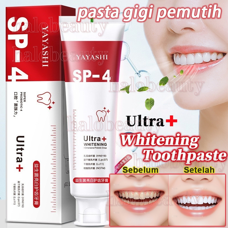 Jual Whitening toothpaste Pasta Gigi Probiotik SP-4 Gigi putih Pasta ...