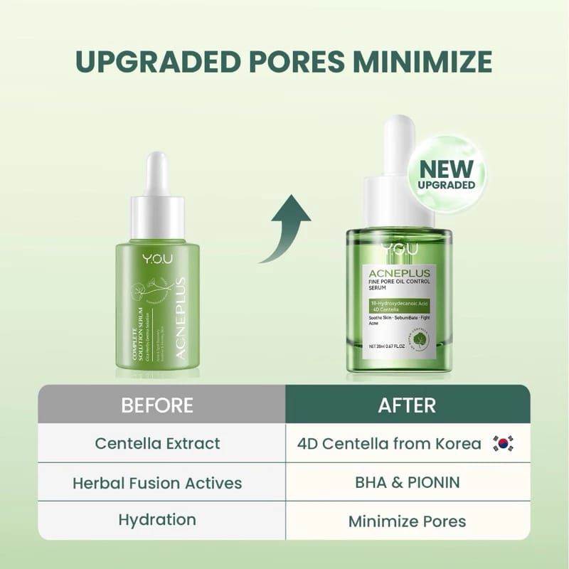 Jual YOU Acne Plus Complete Solution Serum 20ml | Shopee Indonesia