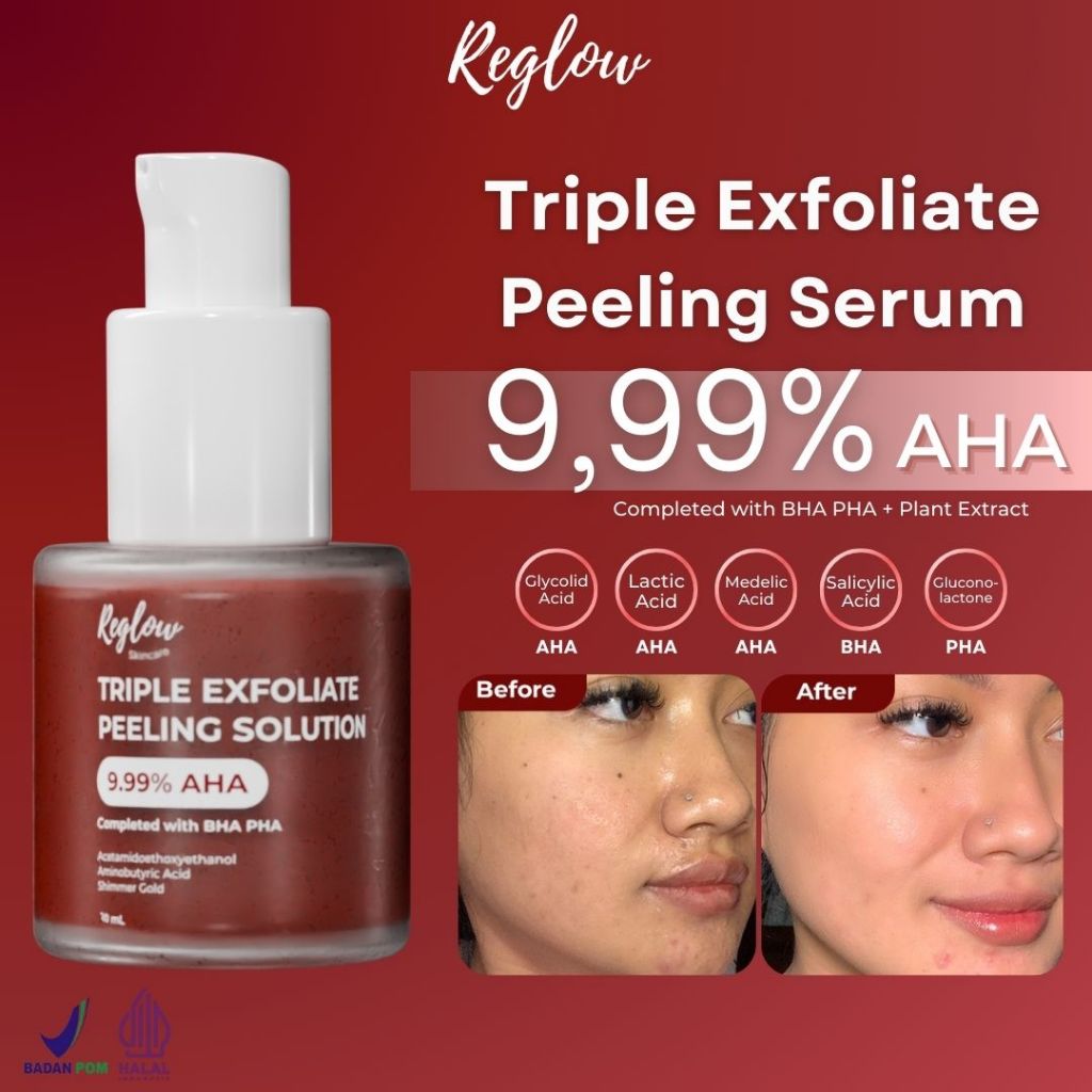 Jual REGLOW Triple Exfoliate Peeling Solution Serum Eksfoliasi AHA BHA PHA - Mengangkat Sel ...