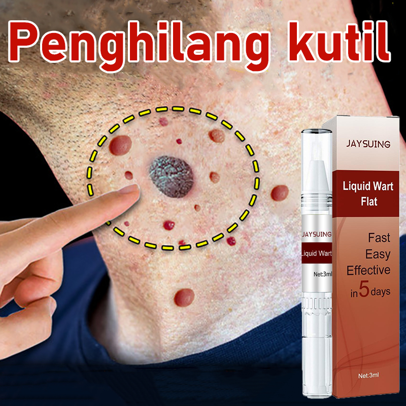 Jual penghilang kutil dan tahi lalat penghilang kutil wart remover pen ...
