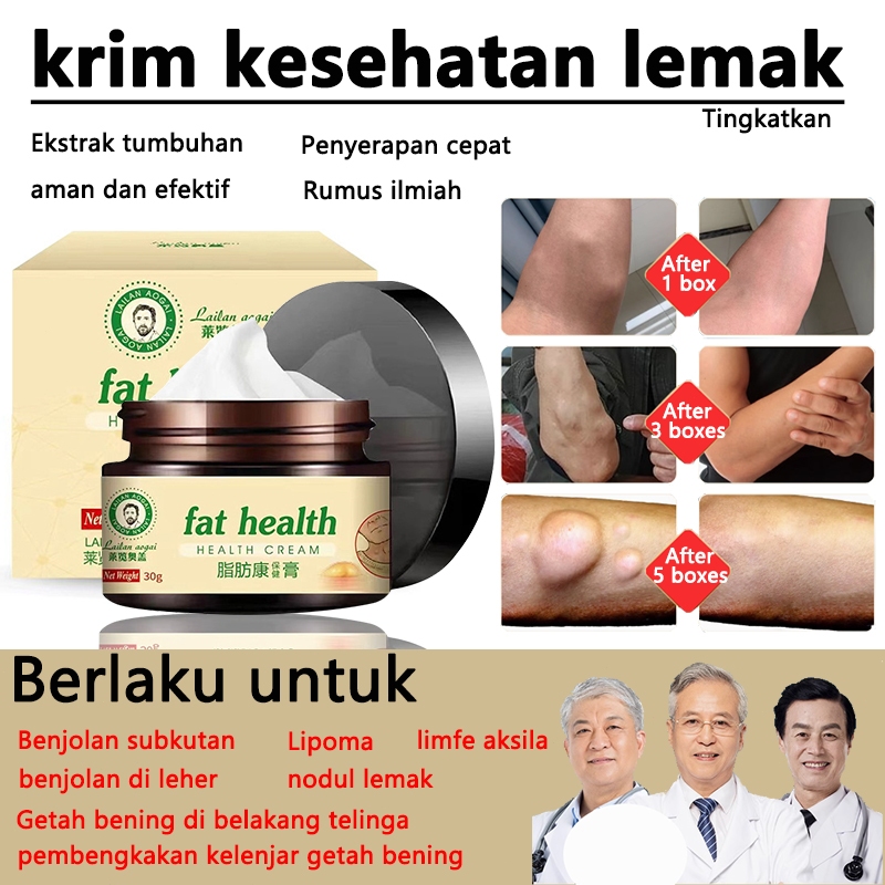 Jual Salep Lipoma, Salep Benjolan 30g, Semprotan Pengangkat Lipoma ...