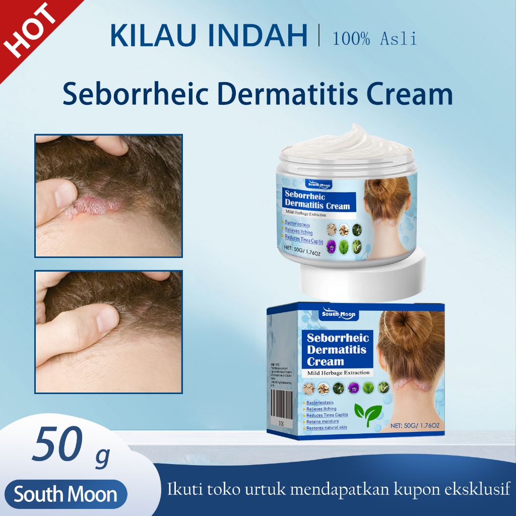 Jual South Moon Seborrheic Dermatitis Cream 50g Obat Dermatitis Seboroik /Krim Kulit Gatal Non ...