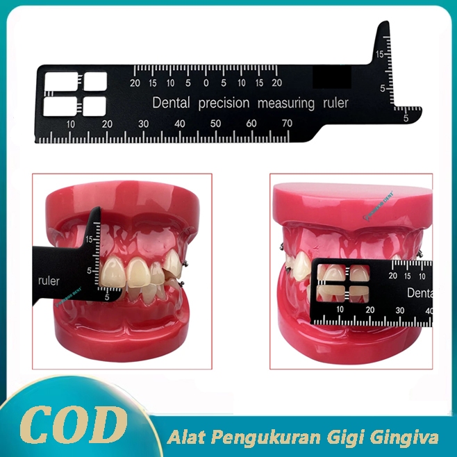 Jual Dental Precision Measuring Ruler & Gap Gauge - Alat Ukur Fotografi ...