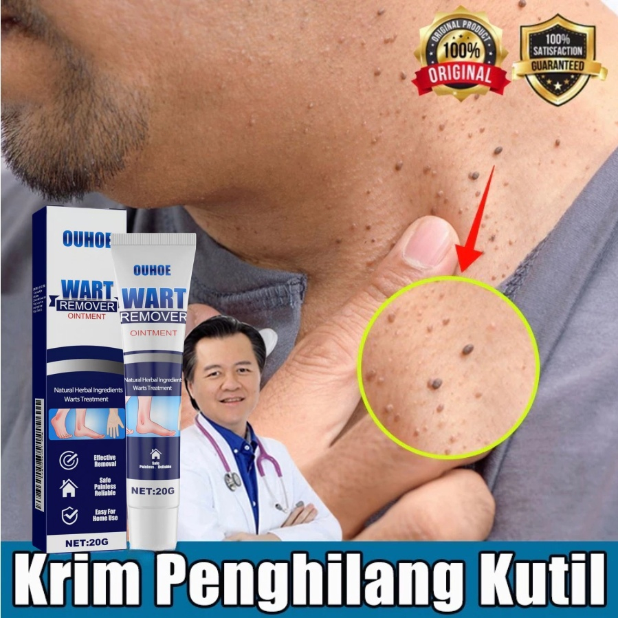Jual Penghilang Tahi Lalat Penghilang Kutil 20g Original Skin Tag ...