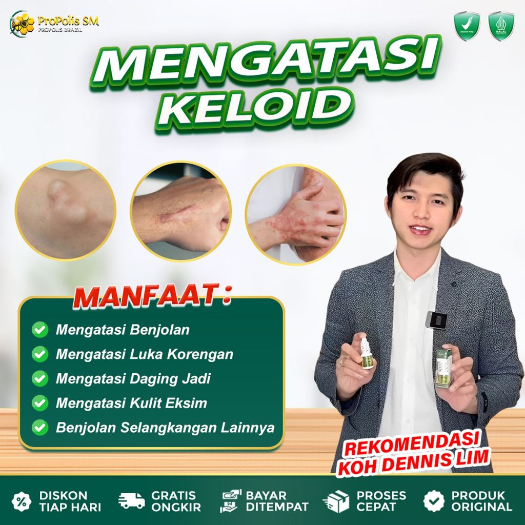 Jual Obat Penghilang Keloid, Daging Tumbuh, Luka Bekas Operasi, Kaki ...