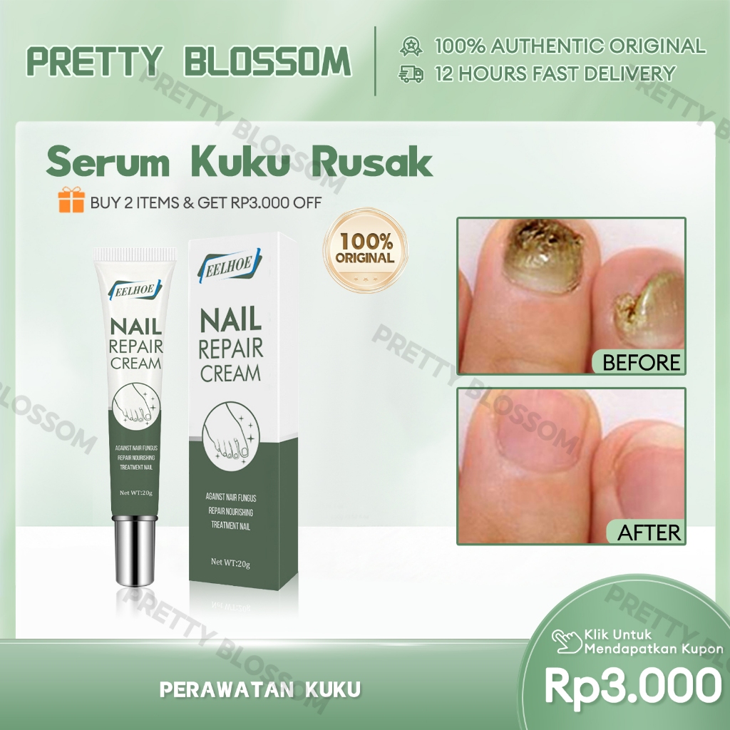 Jual EELHOE Serum Kuku Rusak 20g Obat Jamur Kuku Obat Kuku Jamur Dan ...