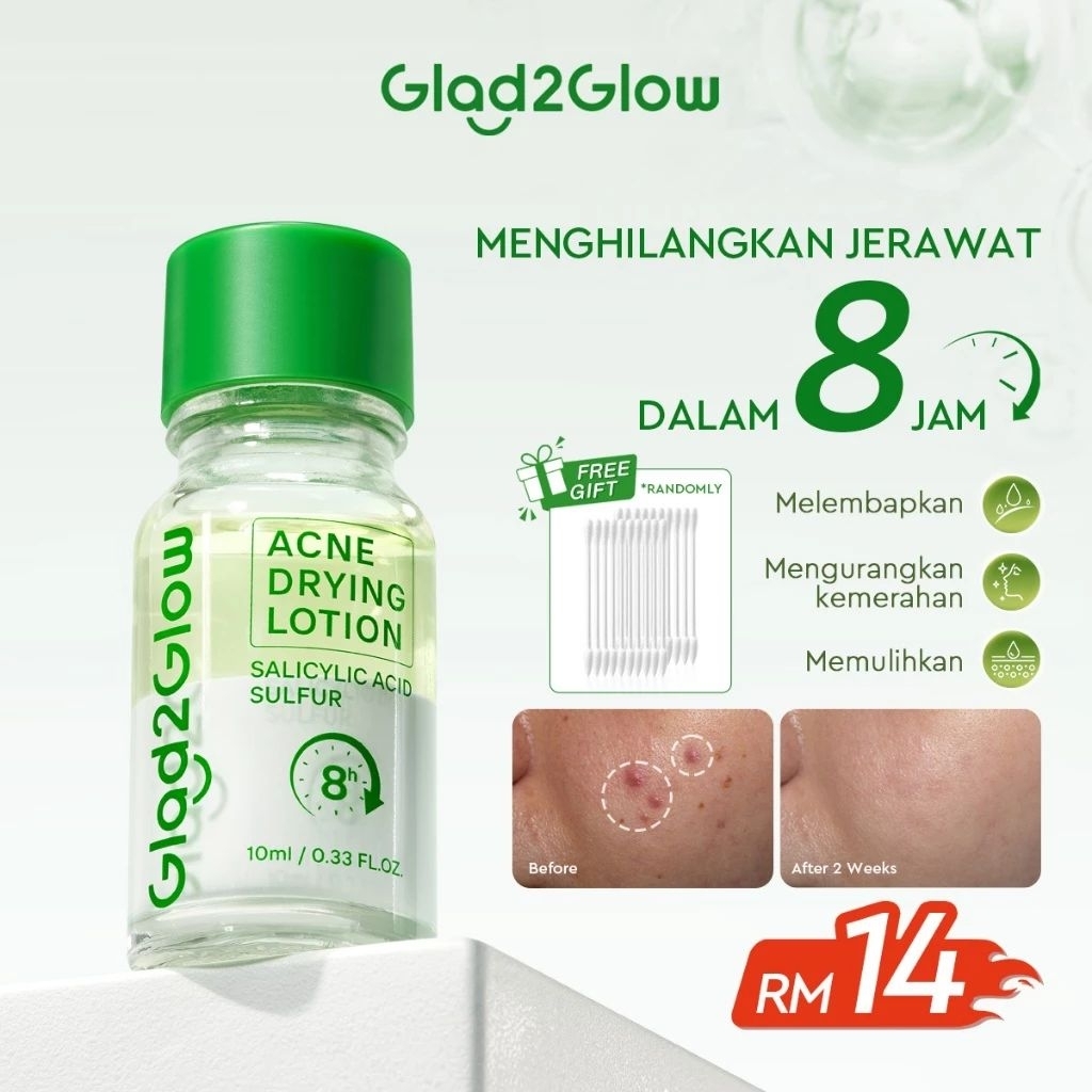 Jual Glad2Glow G2G Acne Drying Lotion | G2G Obat Totol Jerawat | Obat ...