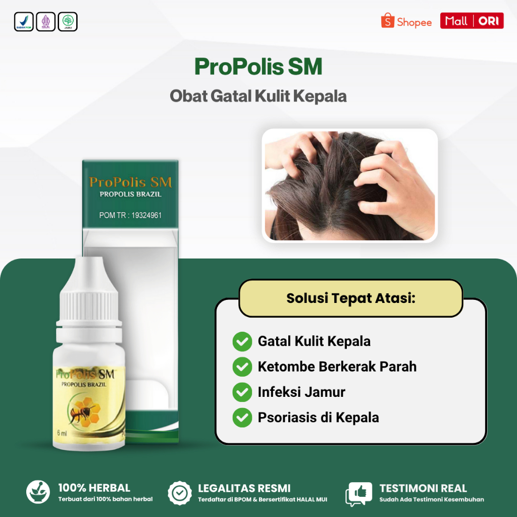 Jual Obat Gatal Kulit Kepala, Ketombe Berkerak Parah, Infeksi Jamur, Psoriasis di Kepala ...