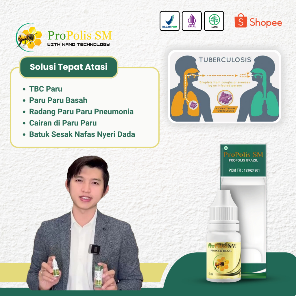 Jual Obat TBC Paru, Paru Paru Basah, Radang Paru Paru Pneumonia, Paru ...