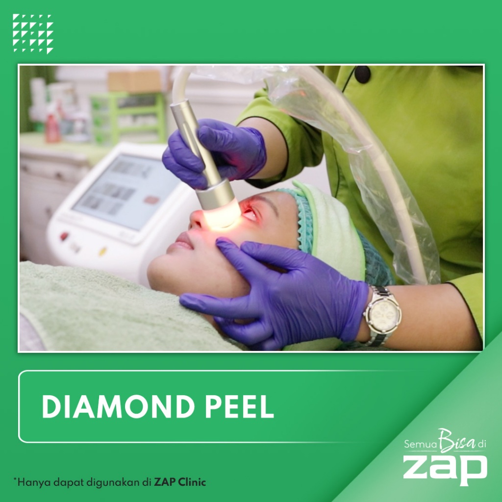 Jual Diamond Peel ZAP | Shopee Indonesia