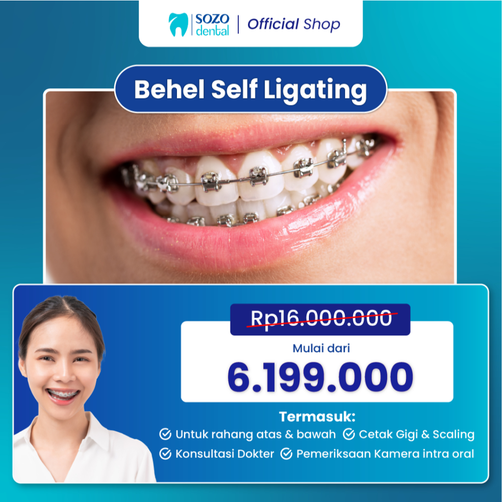 Jual Behel SELF LIGATING Rahang Atas dan Bawah + Basic Scaling + Cetak ...