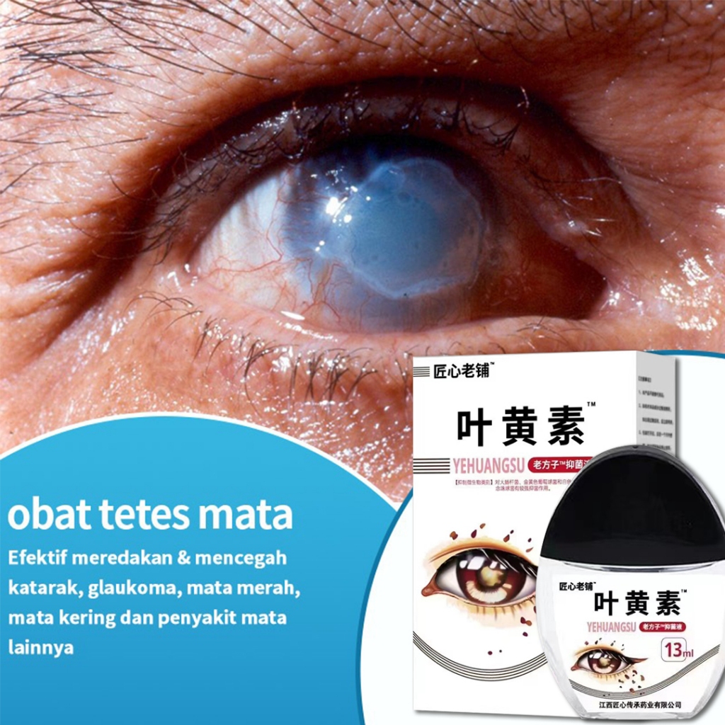 Jual Obat Tetes Mata Obat Mata Katarak Mata Kering Sakit Mata Darah ...