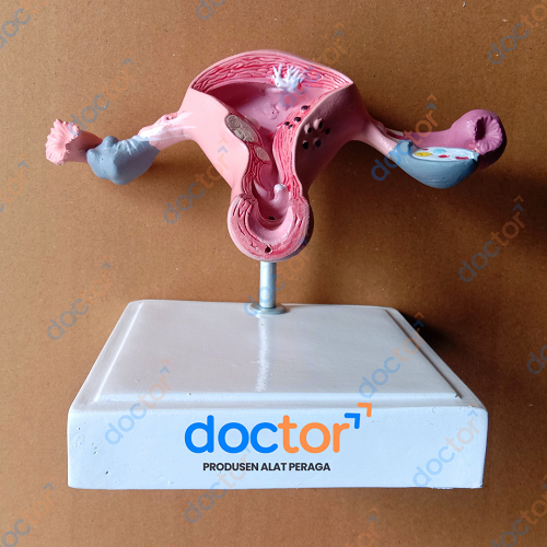 Jual [doctor] Uterus Ovary Anatomical Model Anatomi-Manekin Model ...