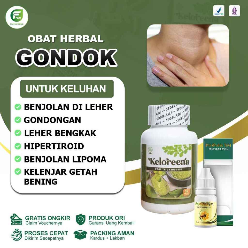 Jual Obat Gondok Benjolan Di Leher Hipertiroid Gondongan Beracun ...
