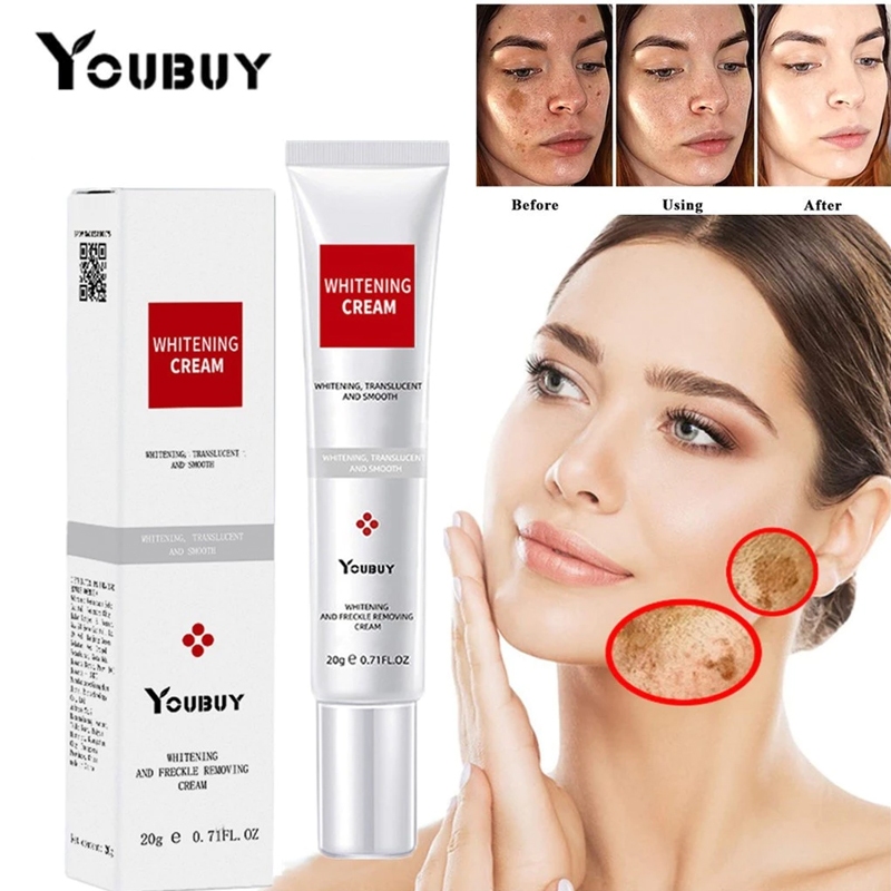 Jual YOUBUY Whitening Remove Dark Spots Anti Freckle Cream Niacinamide Fade Pigmentation Melasma ...