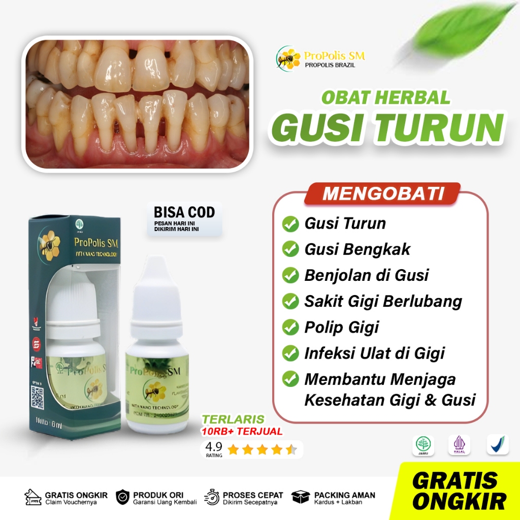 Jual Obat Radang Gusi, Obat Gusi Turun, Obat Gusi Bengkak, Obat Gusi ...