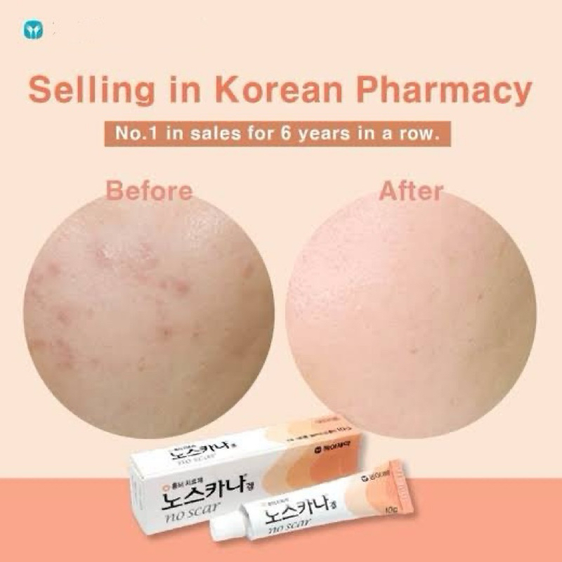Jual Acne Cream Dong A Noscarna Aclean | Shopee Indonesia