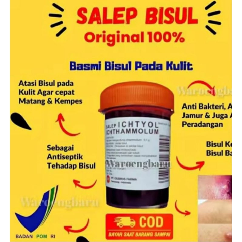 Jual SALEP BISUL ORIGINAL 100℅(SALEP HITAM ICHTYOL) | Shopee Indonesia