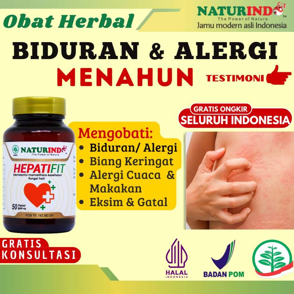 Jual Obat Biduran Alergi Dingin Gatal Kulit Biang Keringat Kaligata ...