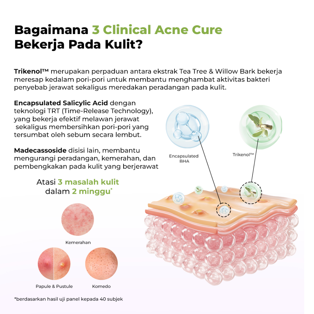 Jual Facetology Bundling Triple Care Acne Calm Moisturizer 35 gr ...