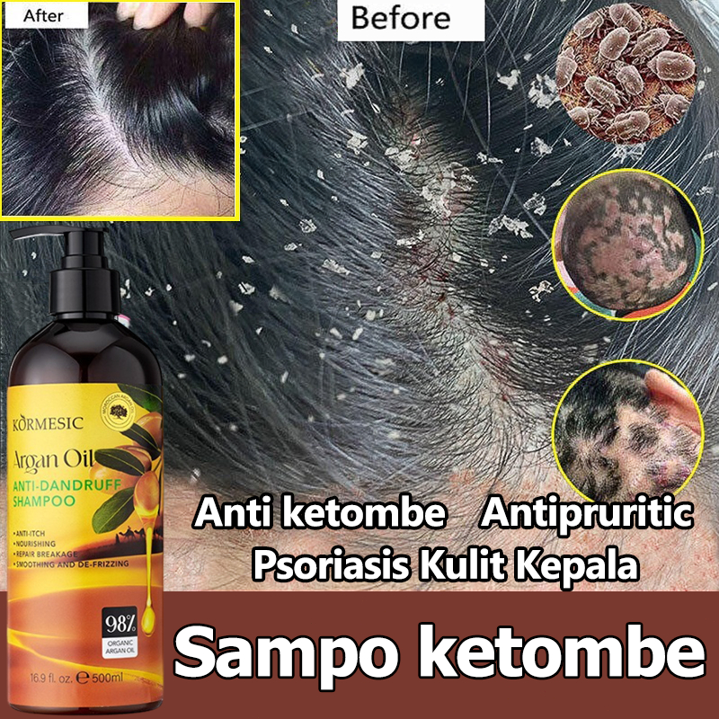 Jual Shampoo anti ketombe Shampoo anti rontok Argan oil shampoo 500ml Anti ketombe Anti rontok ...